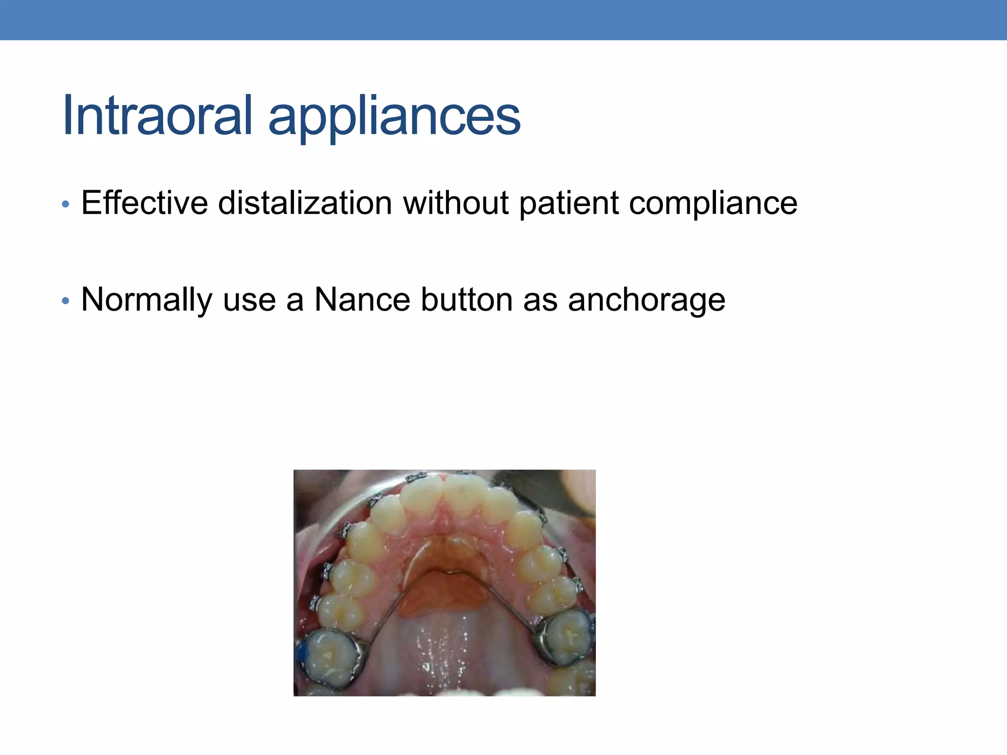 Intraoral Distalizing Devices | PPTX