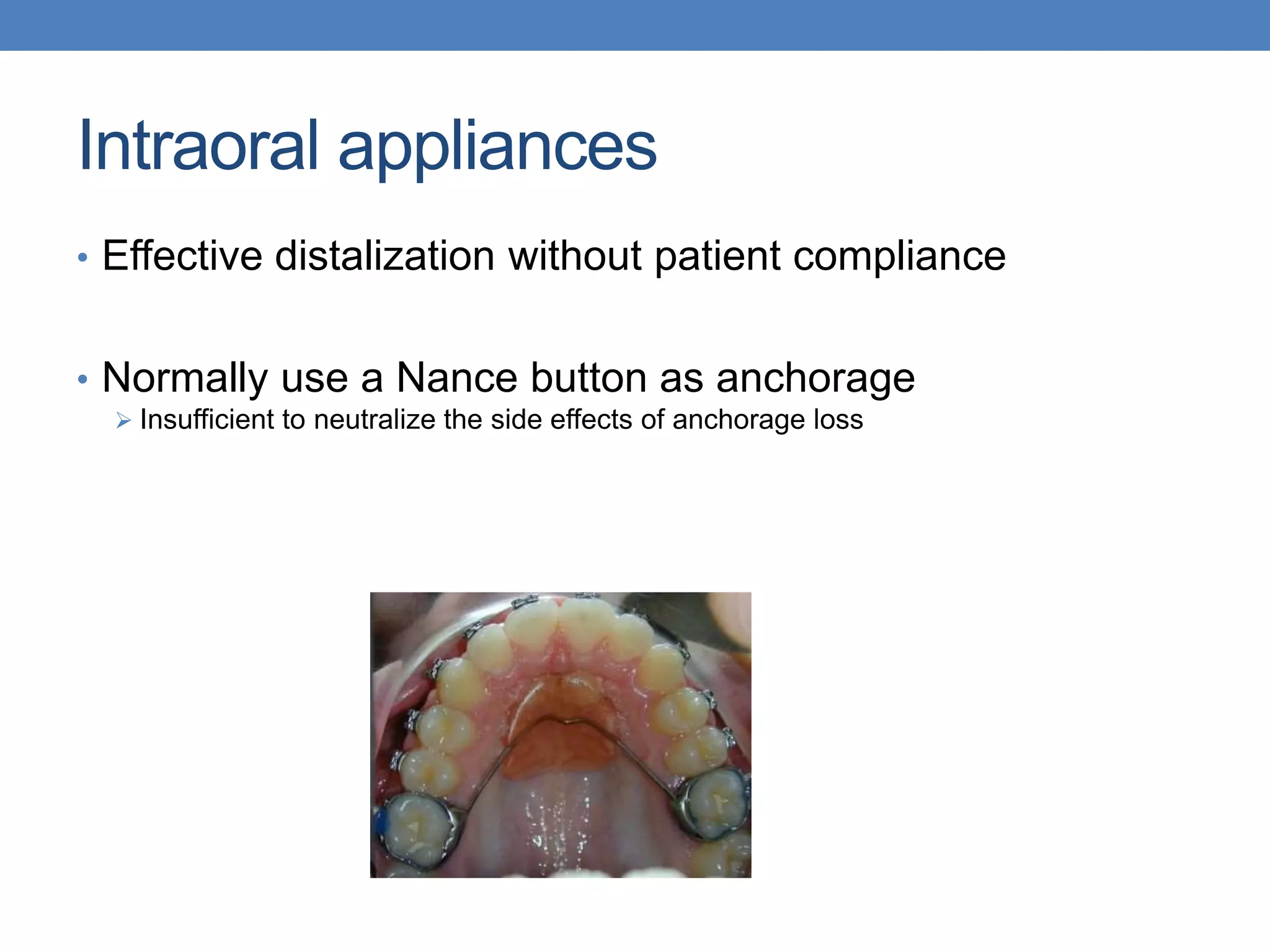 Intraoral Distalizing Devices | PPTX