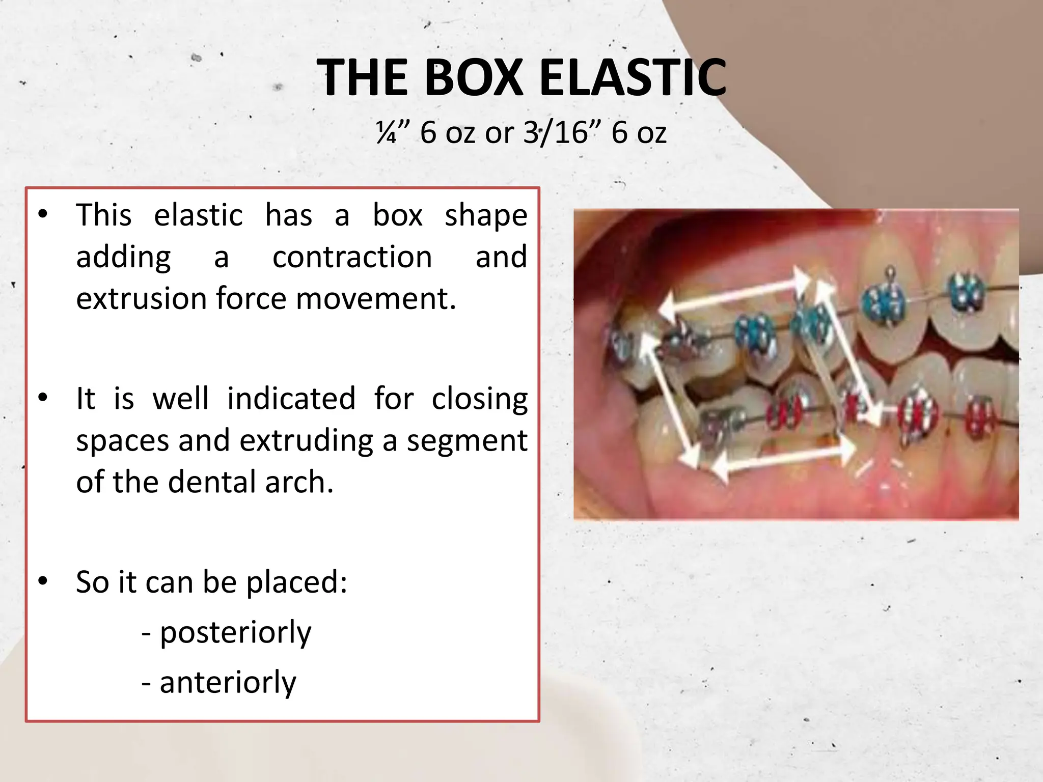 INTRAORAL ELASTICS in orthodontics .pptx