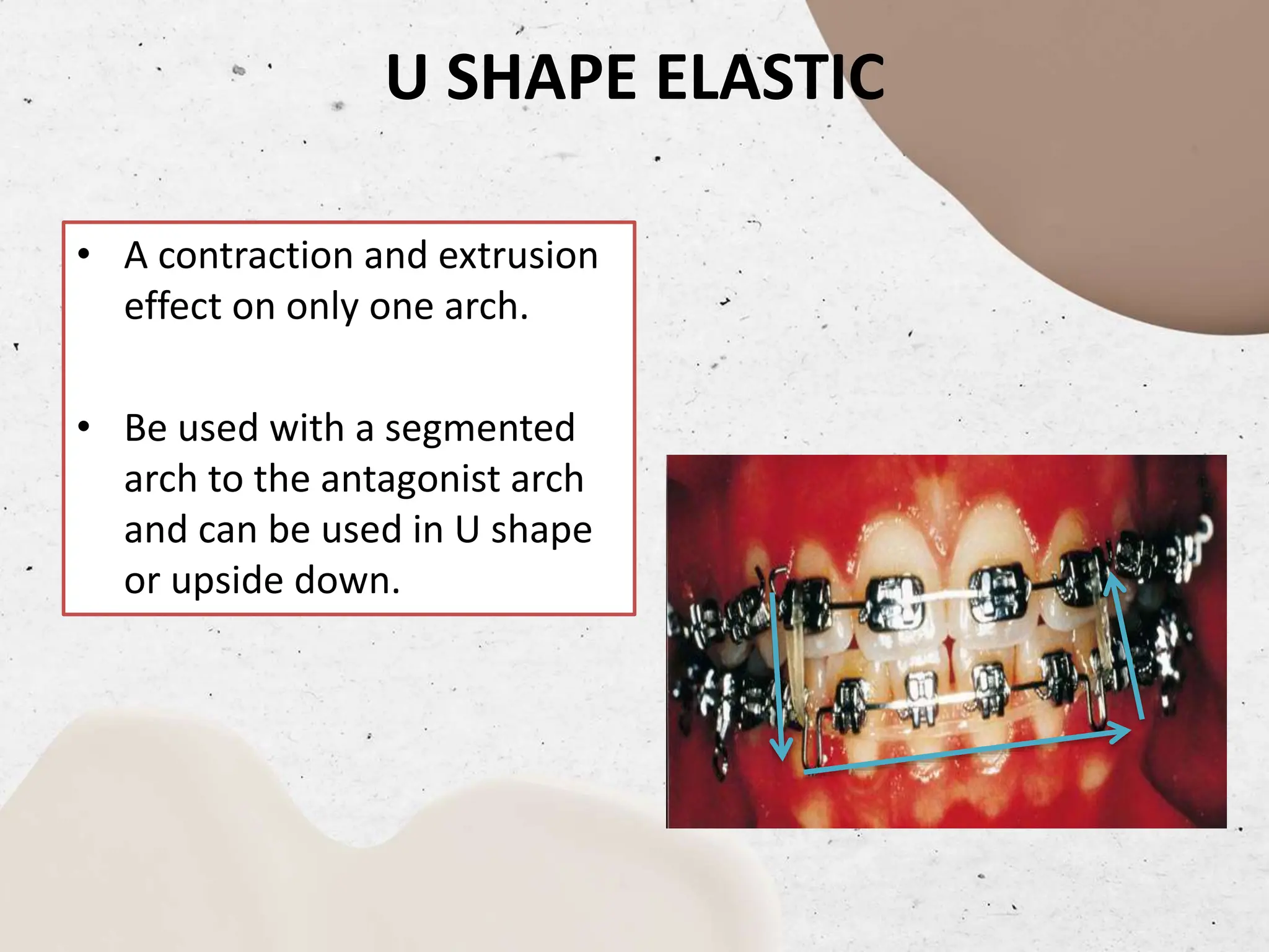 INTRAORAL ELASTICS in orthodontics .pptx