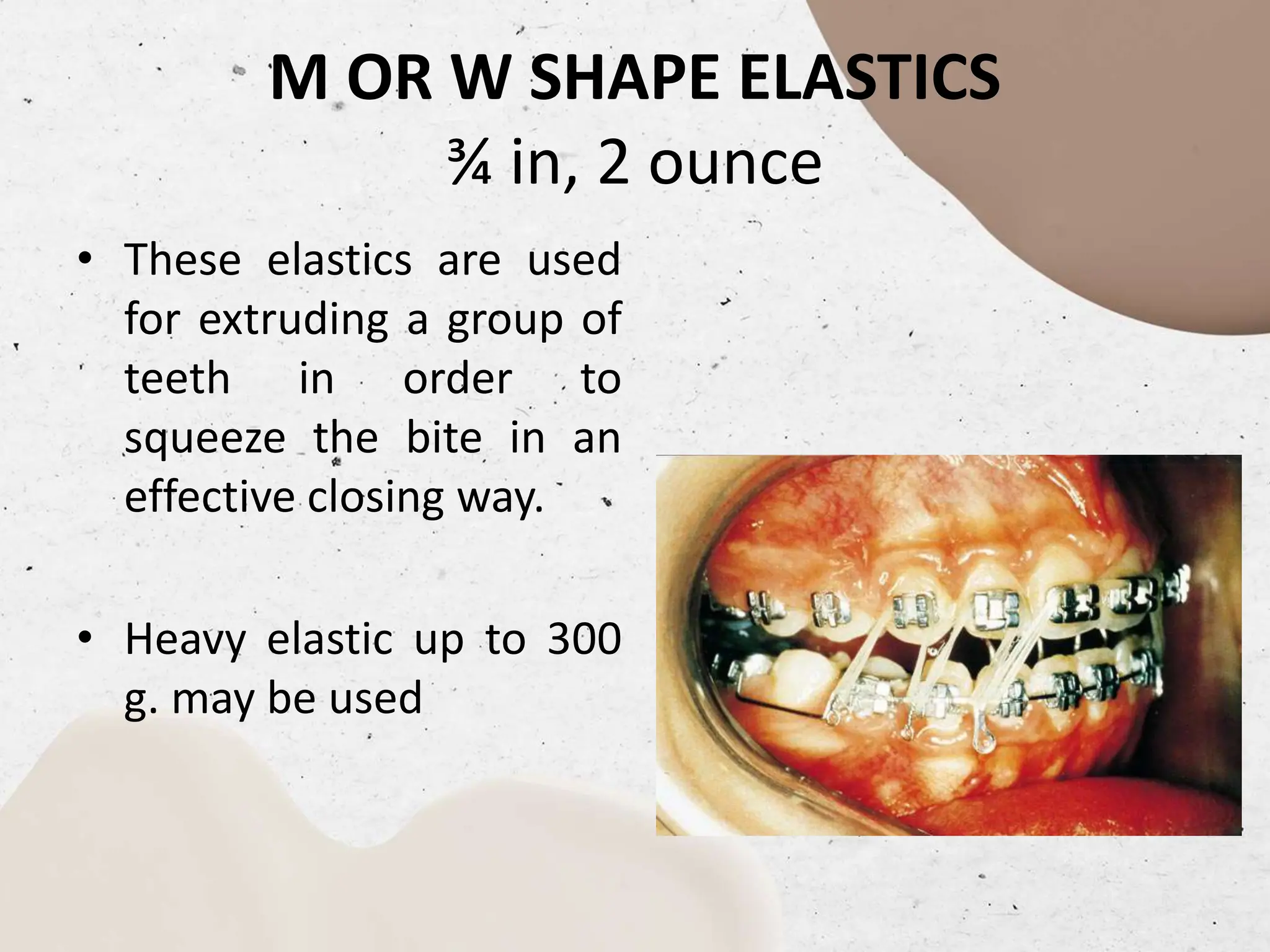 INTRAORAL ELASTICS in orthodontics .pptx