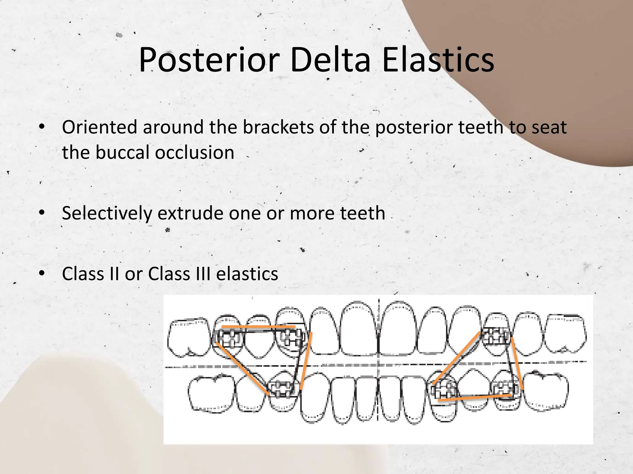 INTRAORAL ELASTICS in orthodontics .pptx