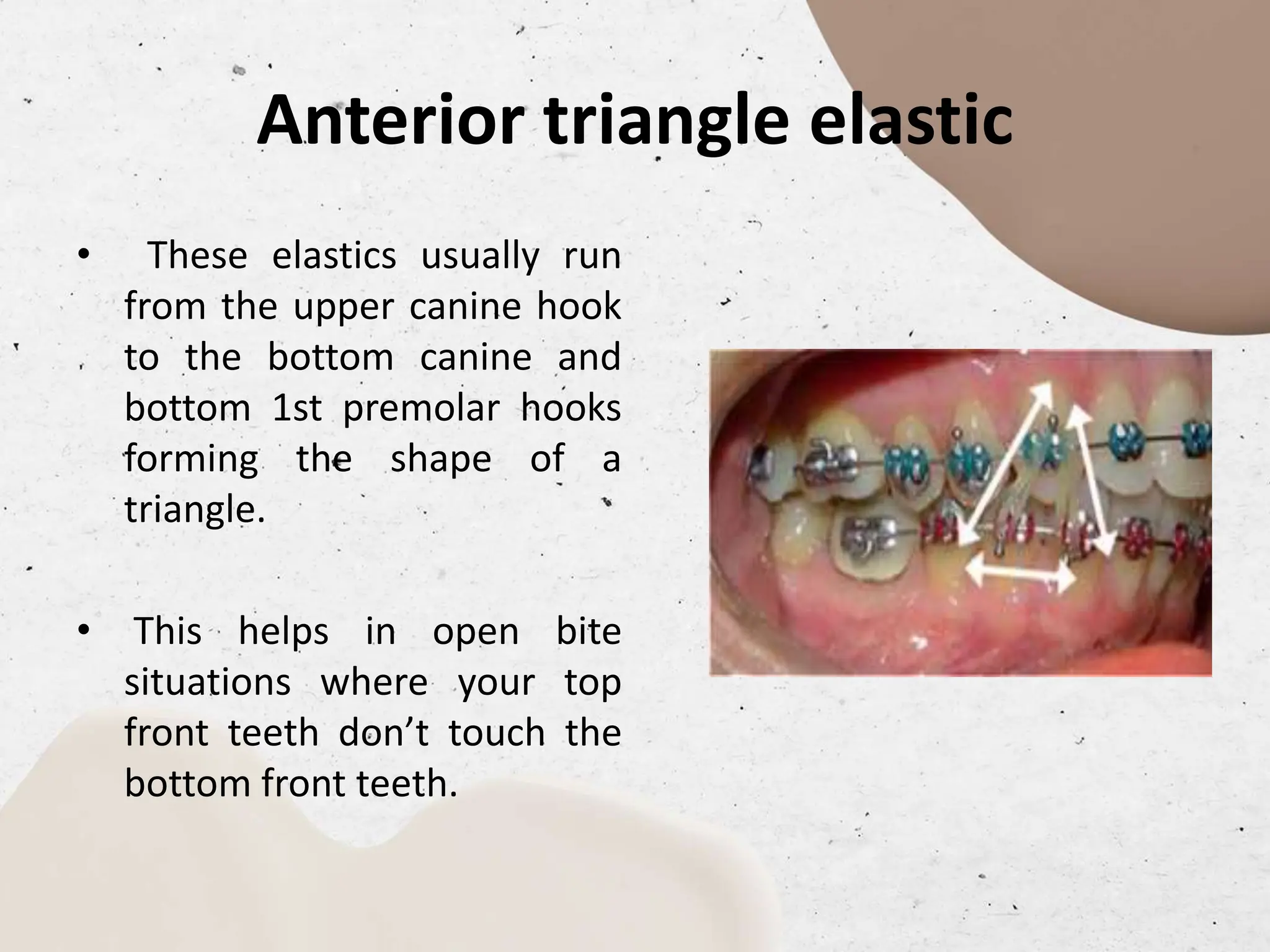 INTRAORAL ELASTICS in orthodontics .pptx