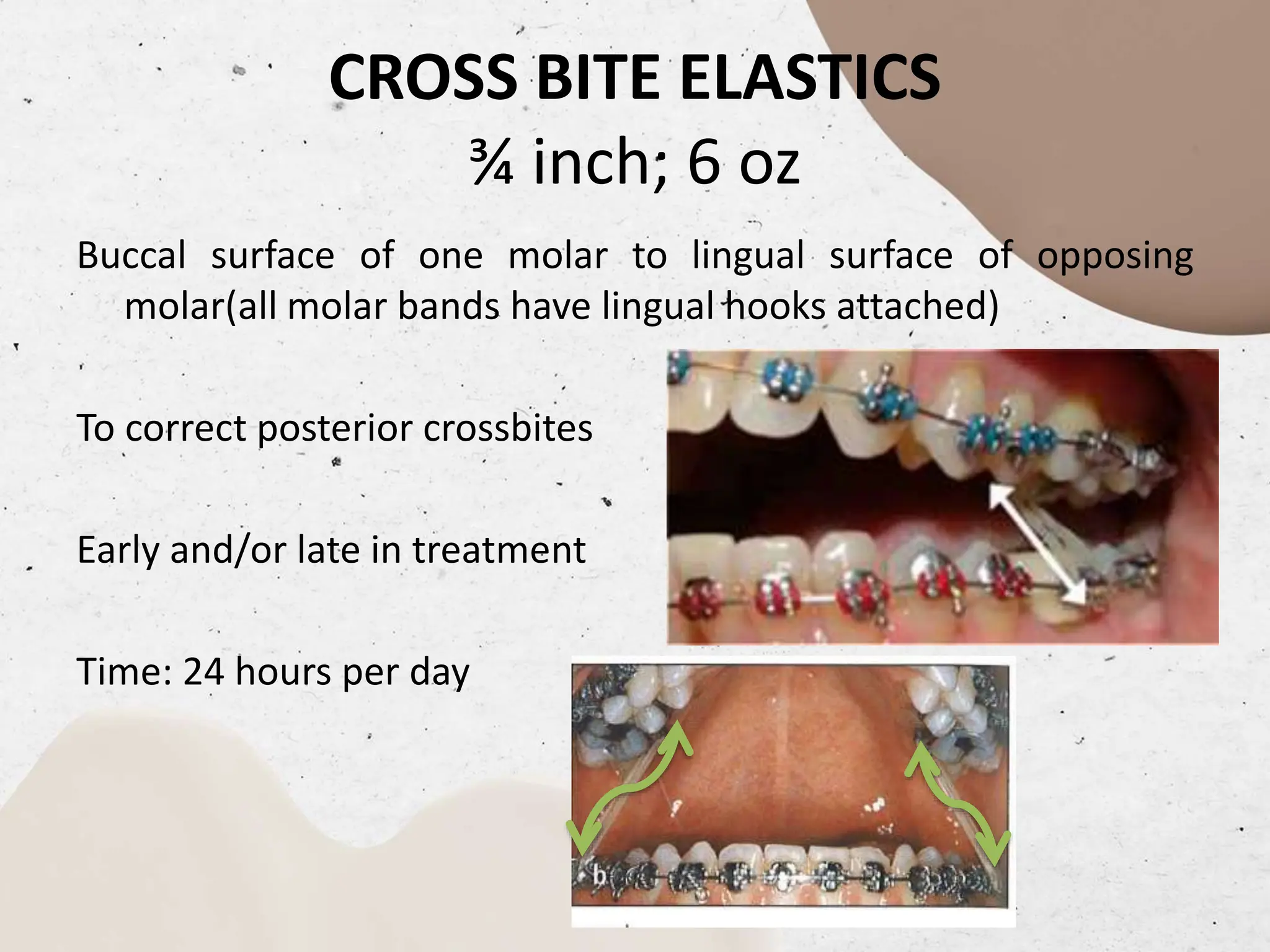 INTRAORAL ELASTICS in orthodontics .pptx