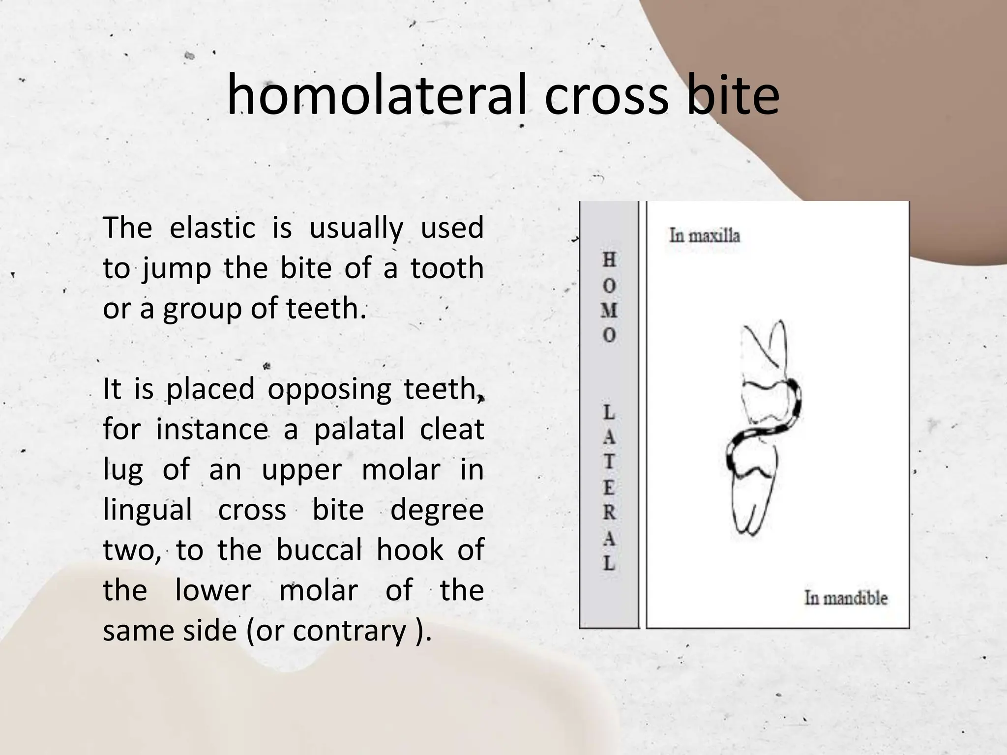INTRAORAL ELASTICS in orthodontics .pptx