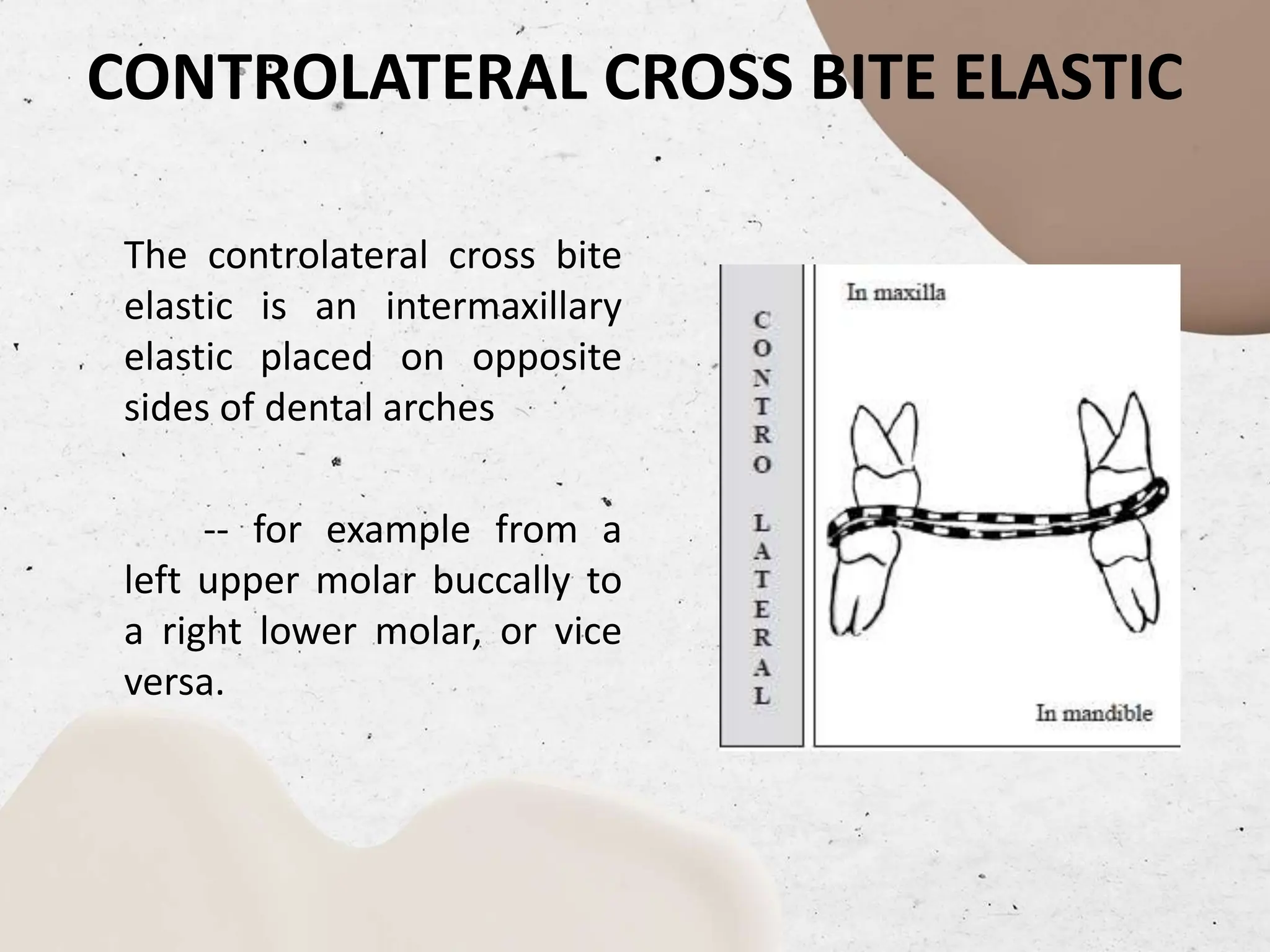 INTRAORAL ELASTICS in orthodontics .pptx