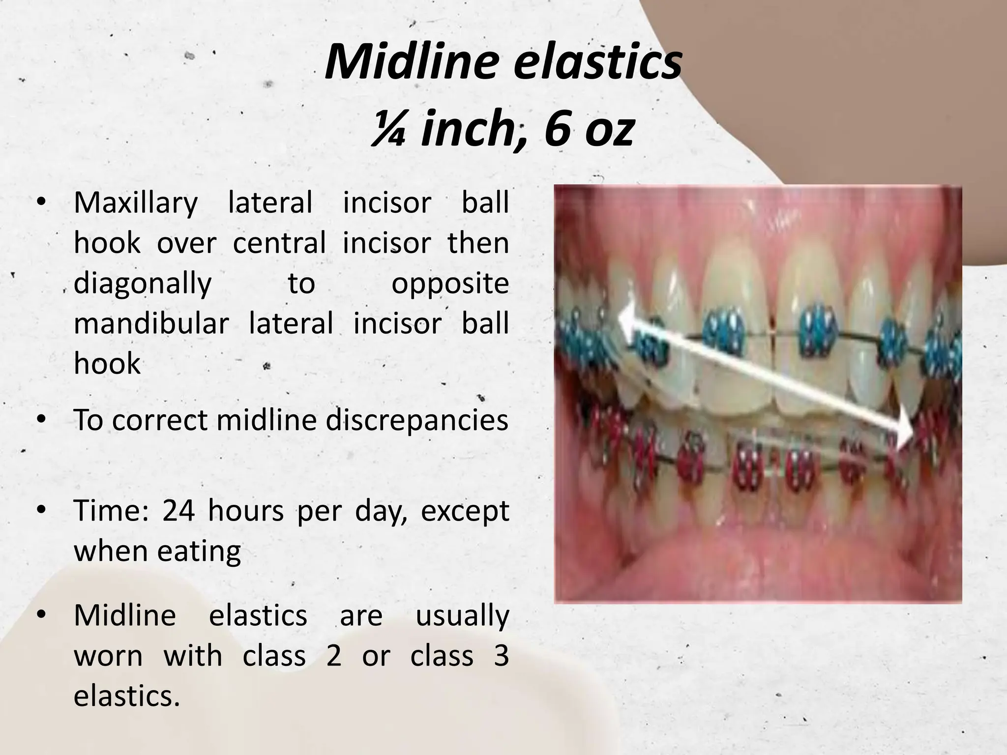 INTRAORAL ELASTICS in orthodontics .pptx