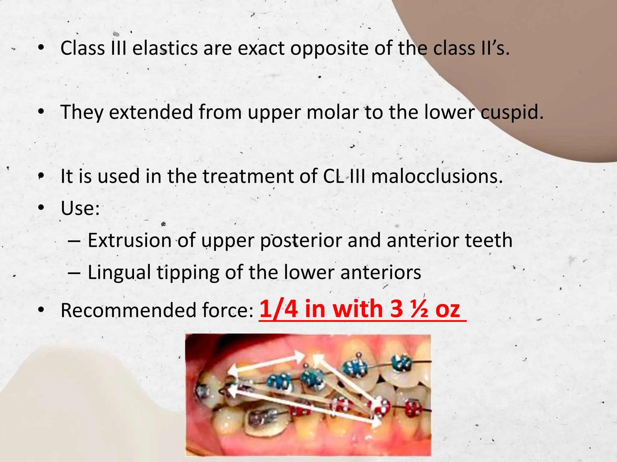 INTRAORAL ELASTICS in orthodontics .pptx