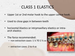 INTRAORAL ELASTICS in orthodontics .pptx