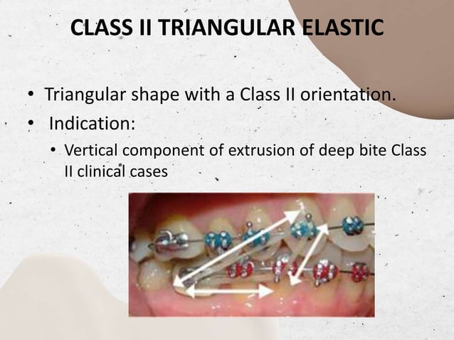 INTRAORAL ELASTICS in orthodontics .pptx