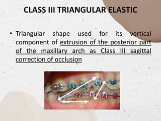 INTRAORAL ELASTICS in orthodontics .pptx