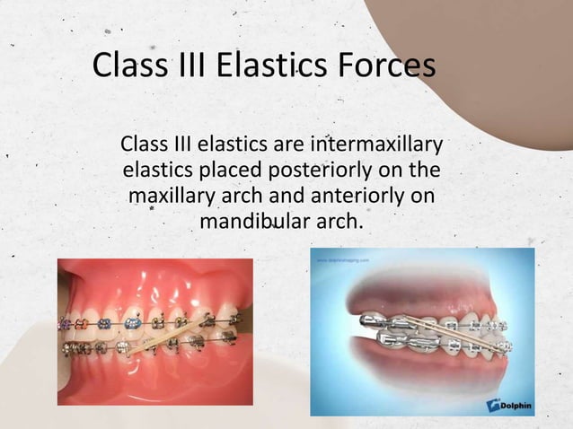 INTRAORAL ELASTICS in orthodontics .pptx