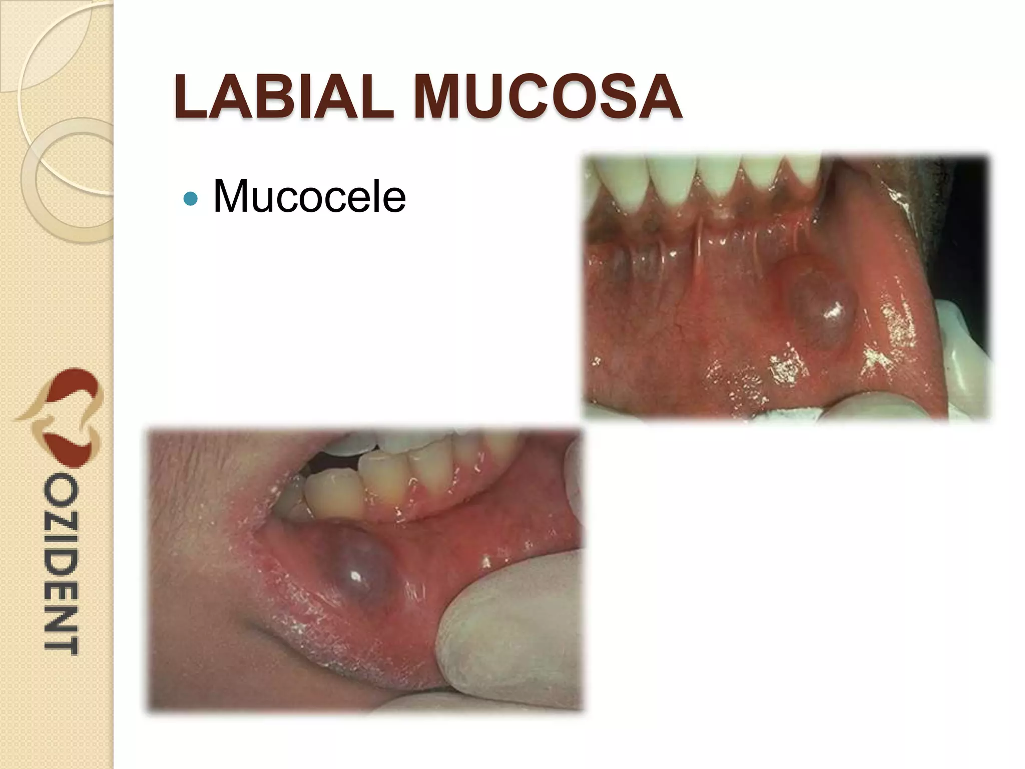 Intra oral examination | PPTX