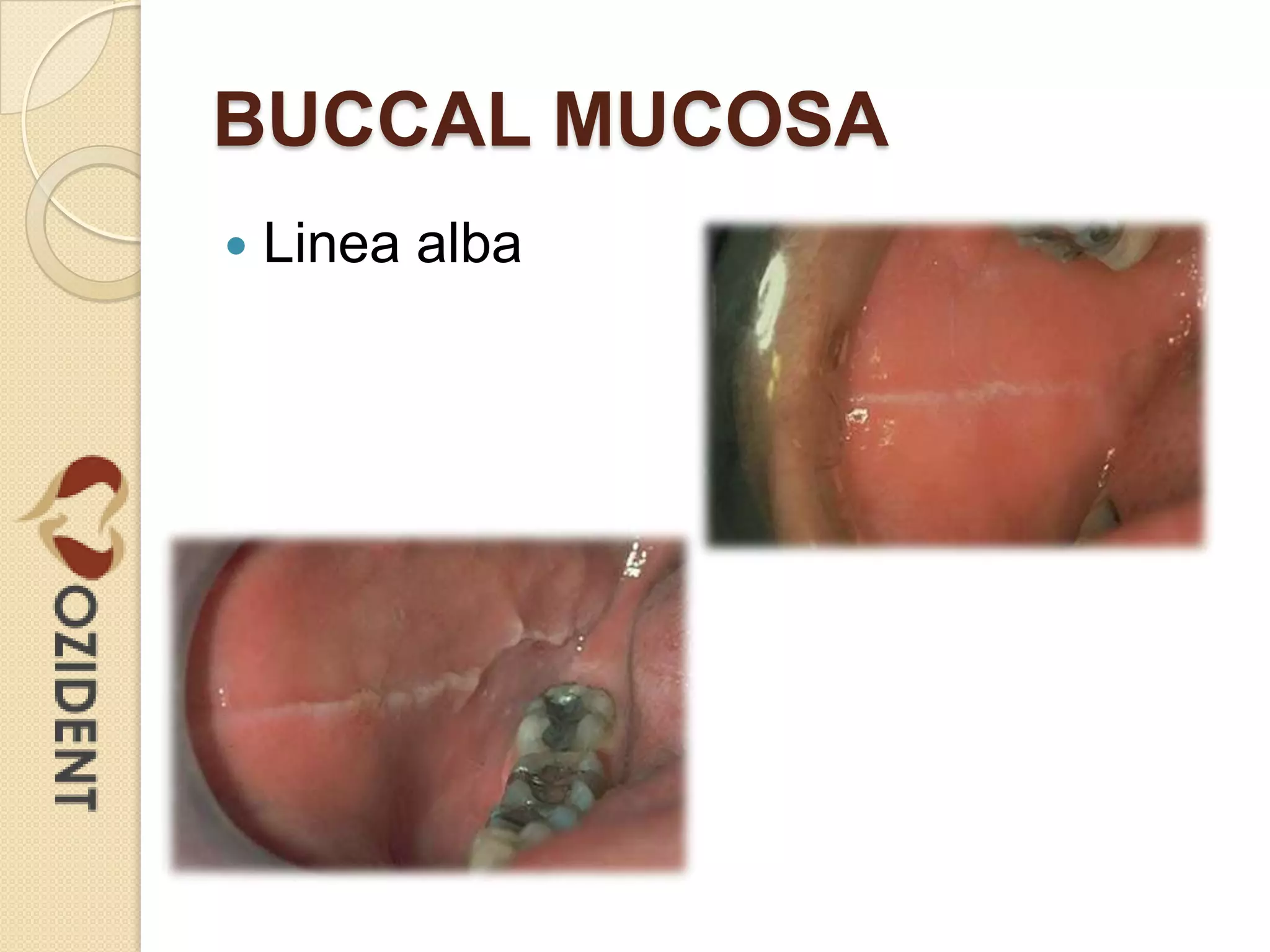 Intra oral examination | PPTX