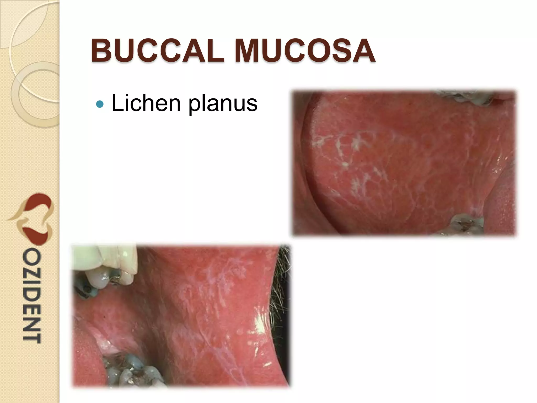 Intra oral examination | PPTX