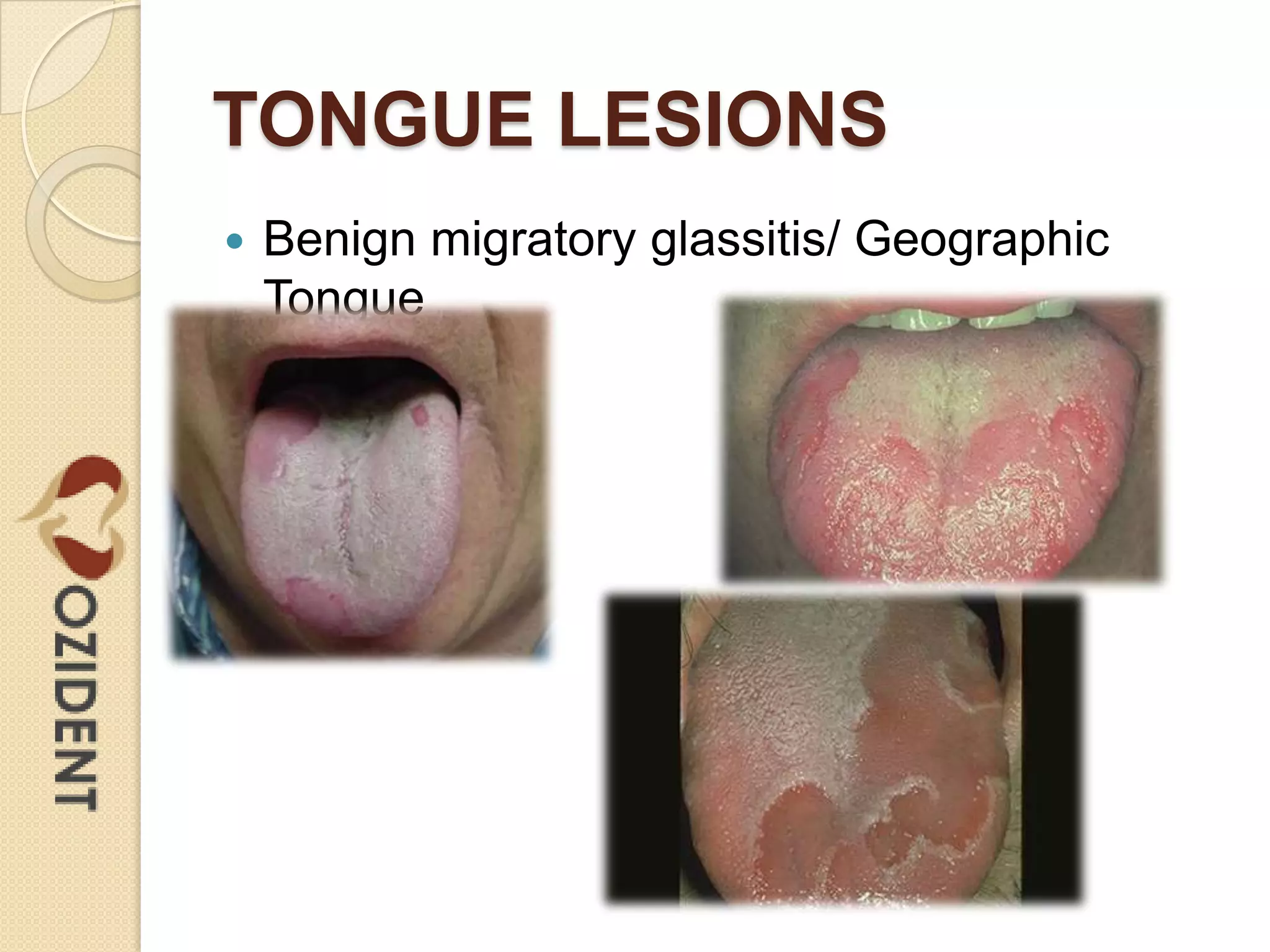 Intra oral examination | PPTX