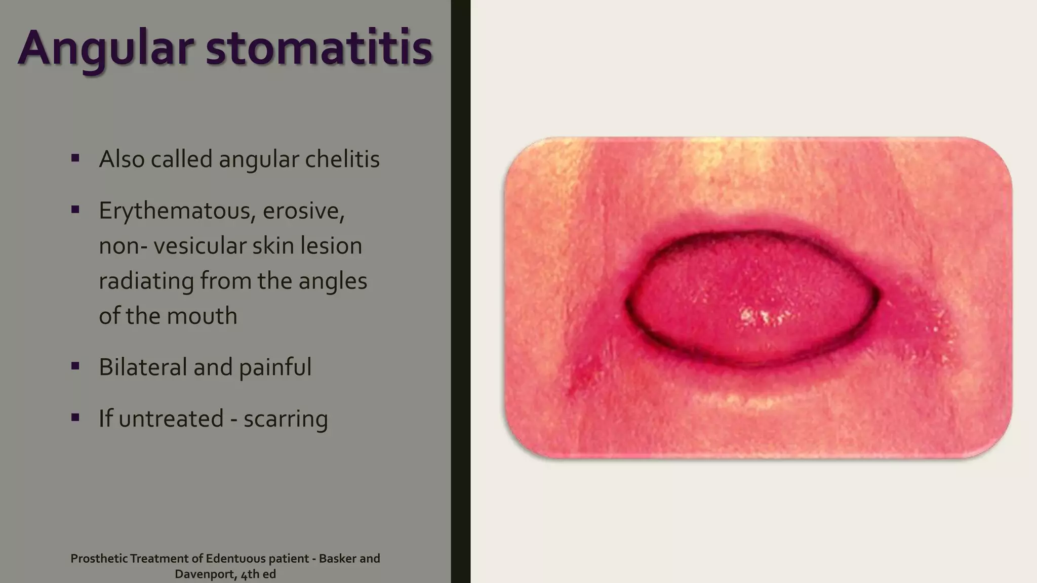 Intra oral examination | PPTX