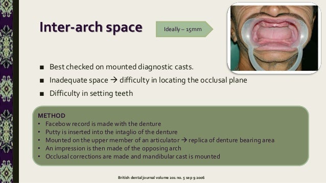 Intra oral examination