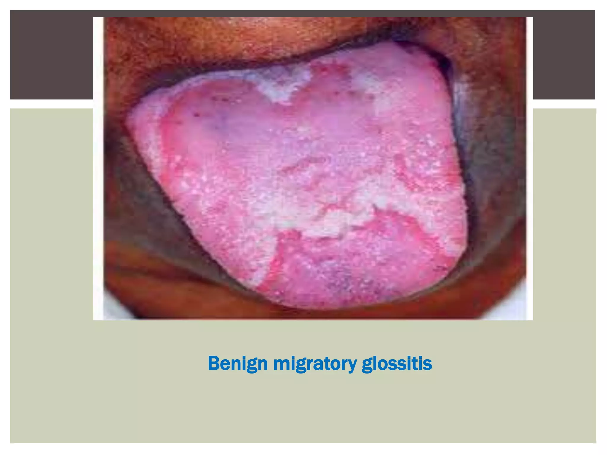 Intra oral examination | PPTX