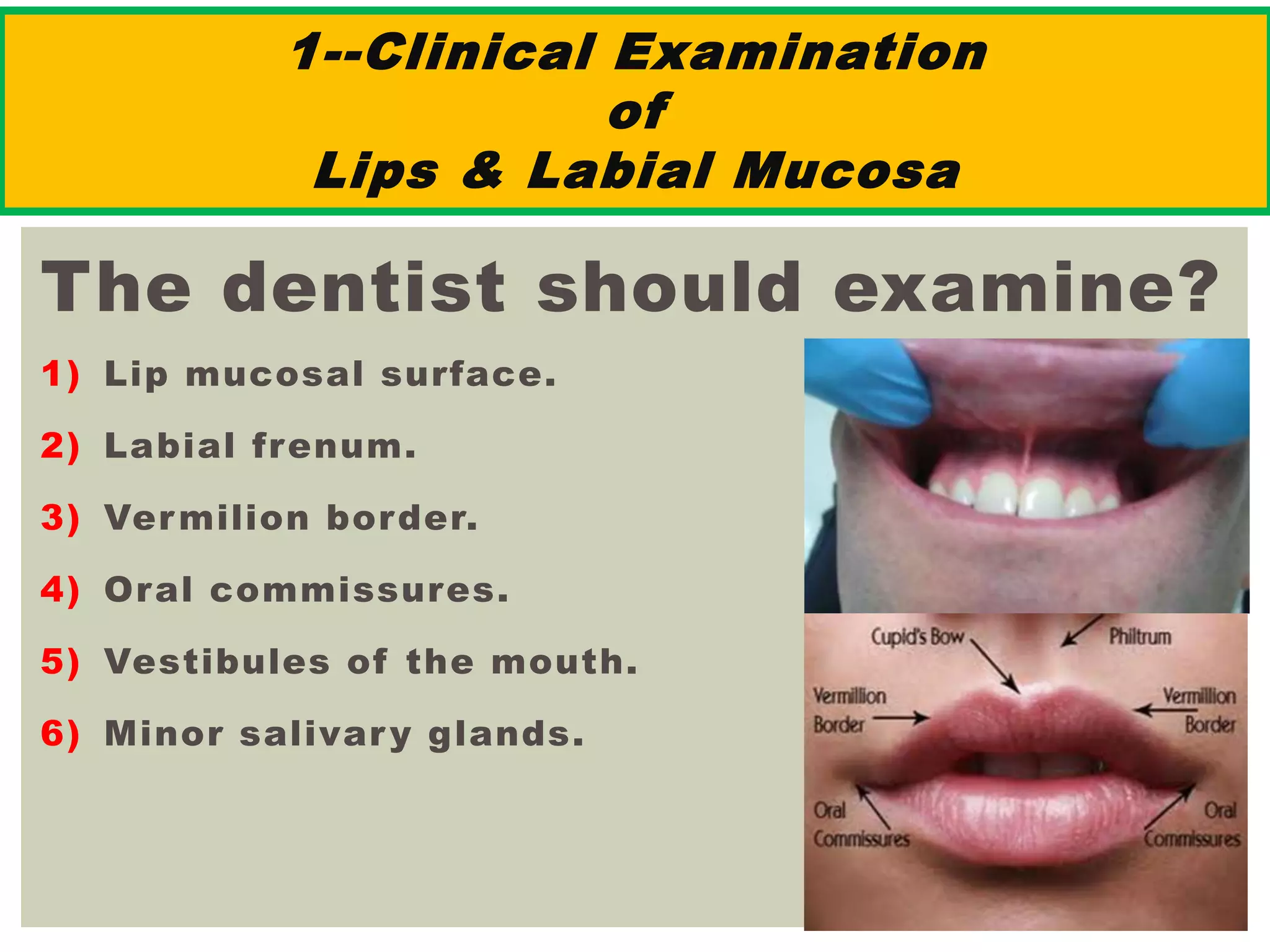 Intra oral examination | PPTX
