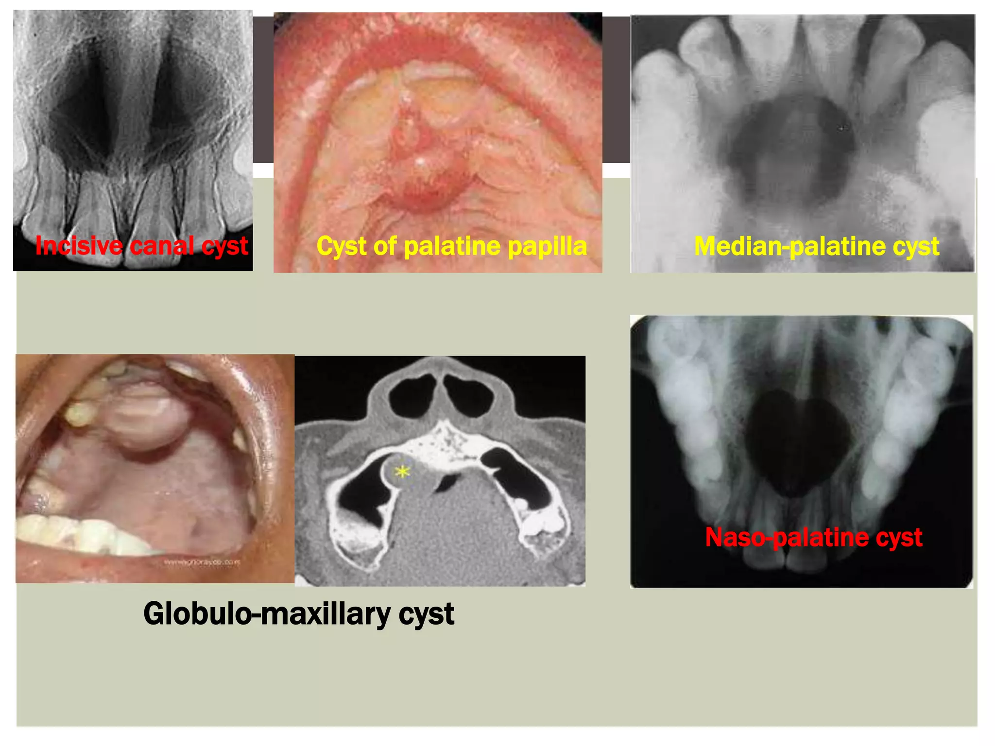 Intra oral examination | PPTX