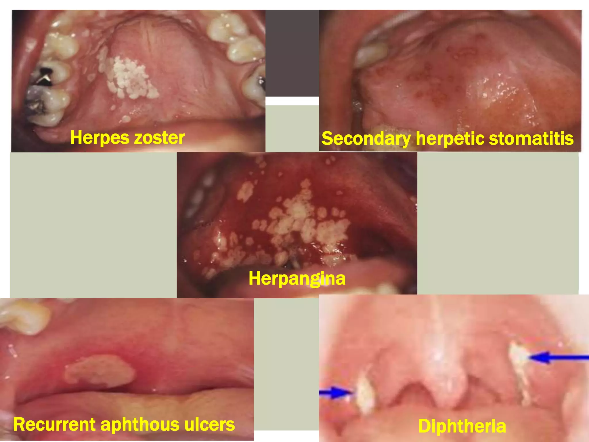 Intra oral examination | PPTX