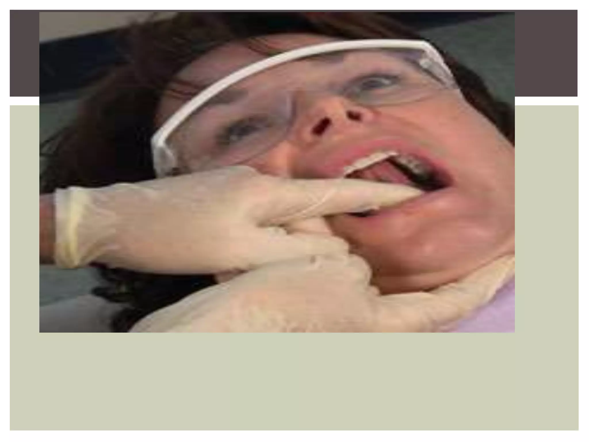 Intra oral examination | PPTX