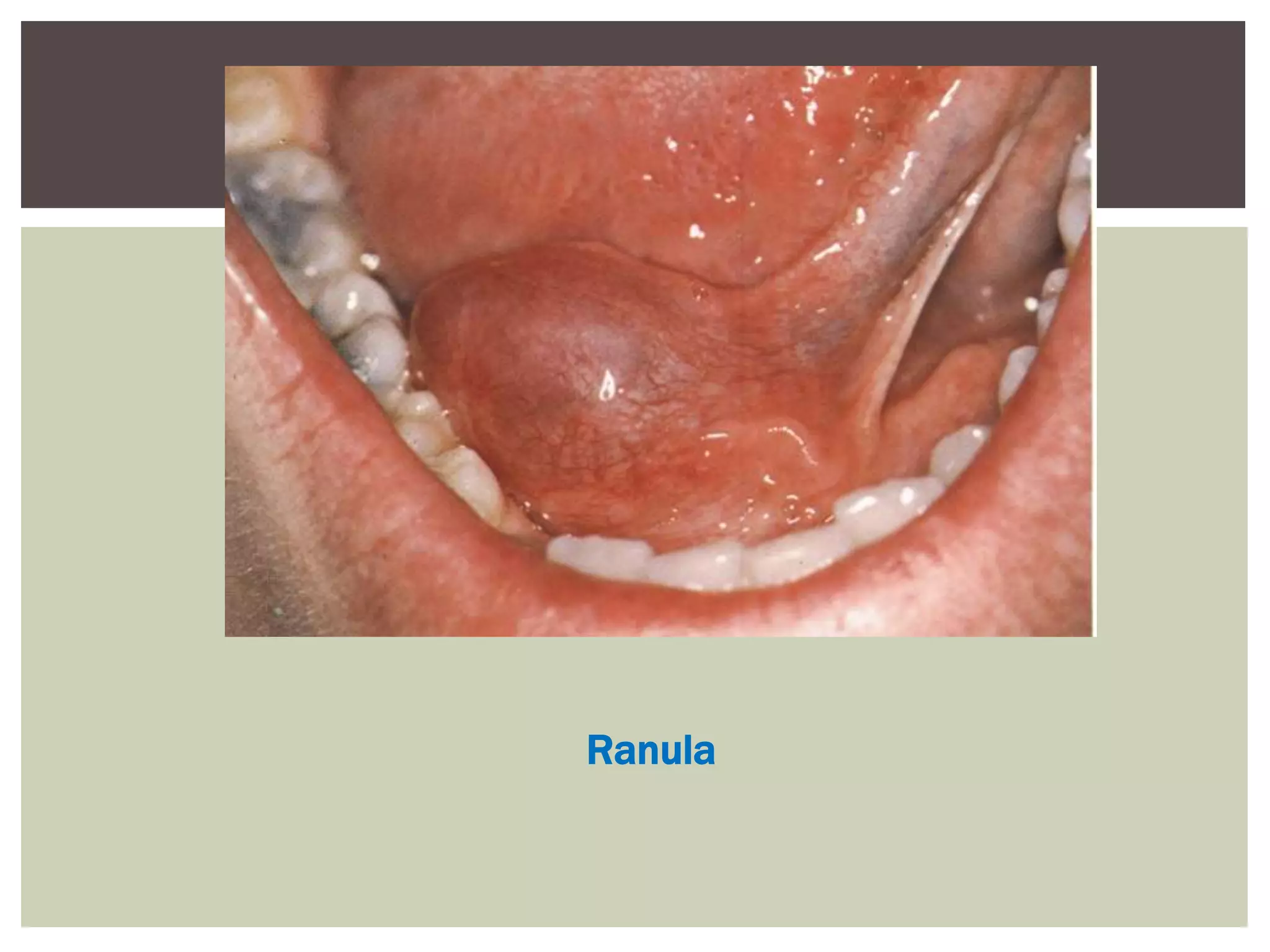 Intra oral examination | PPTX
