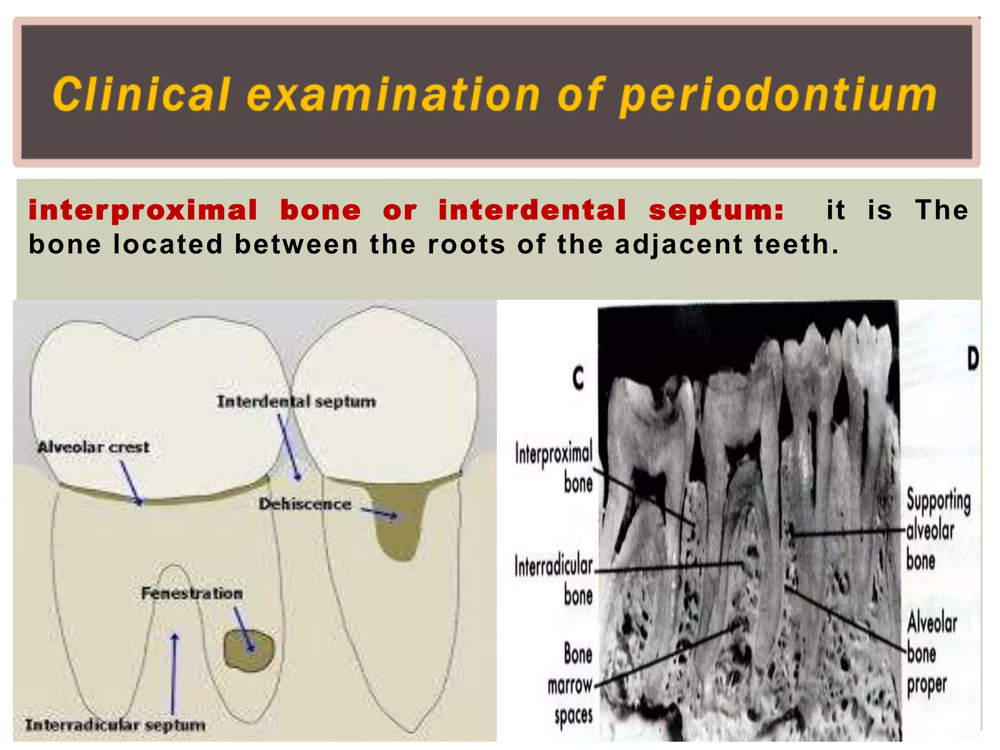 Intra oral examination | PPTX