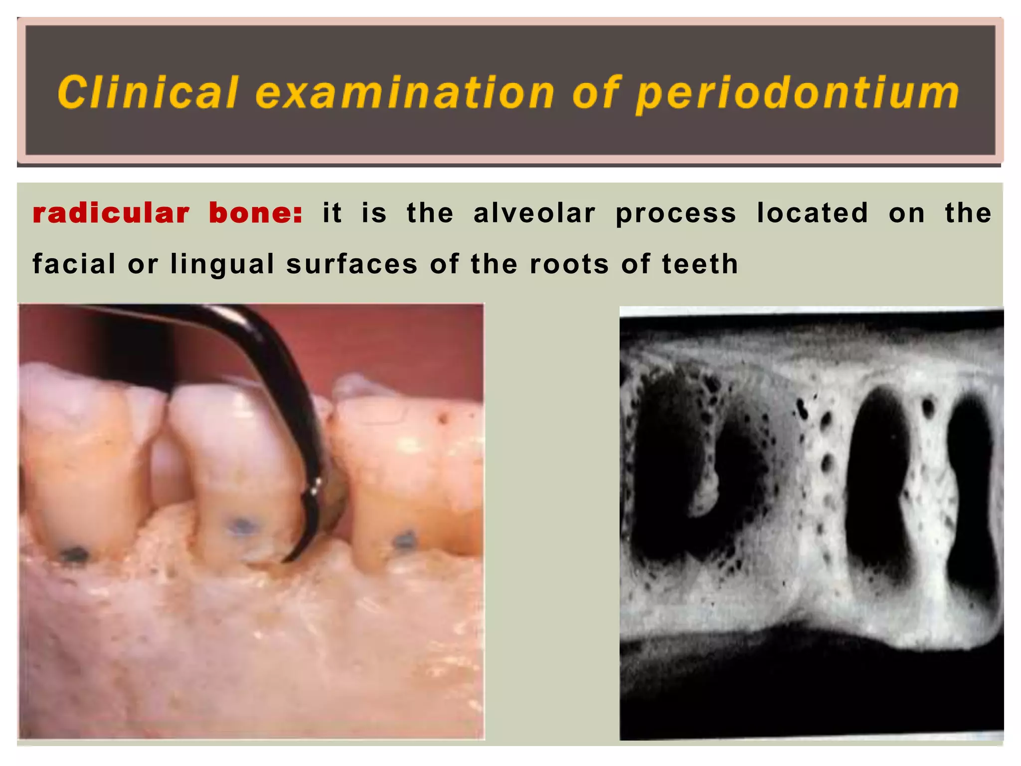 Intra oral examination | PPTX