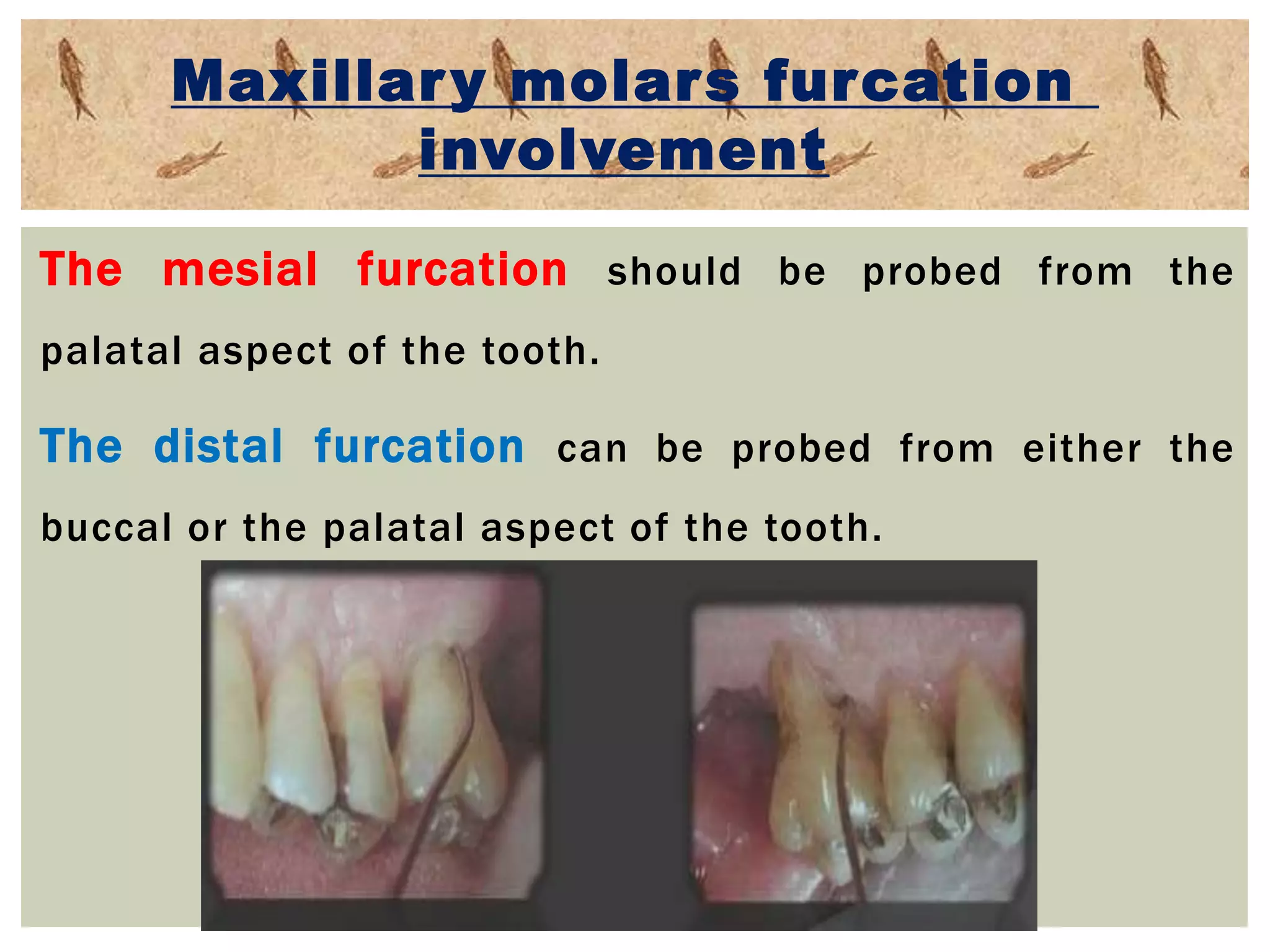 Intra oral examination | PPTX