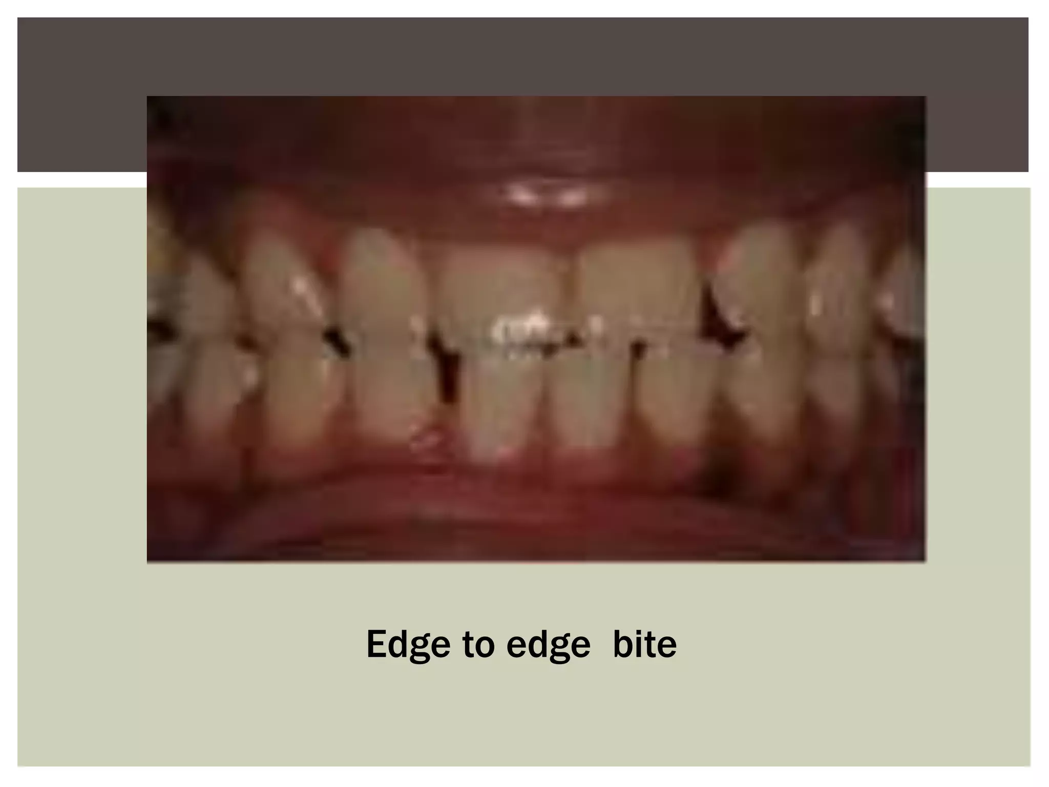 Intra oral examination | PPTX