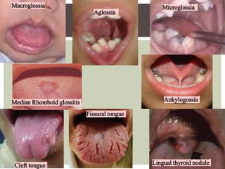 Intra oral examination | PPTX