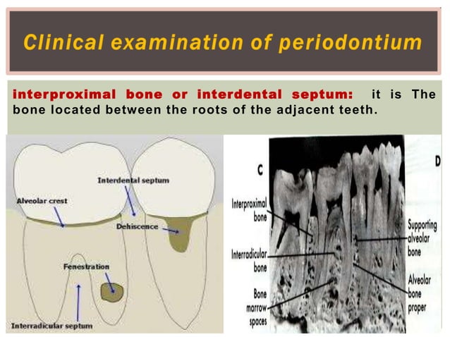 Intra oral examination | PPTX