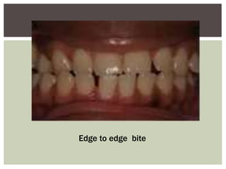 Intra oral examination | PPTX