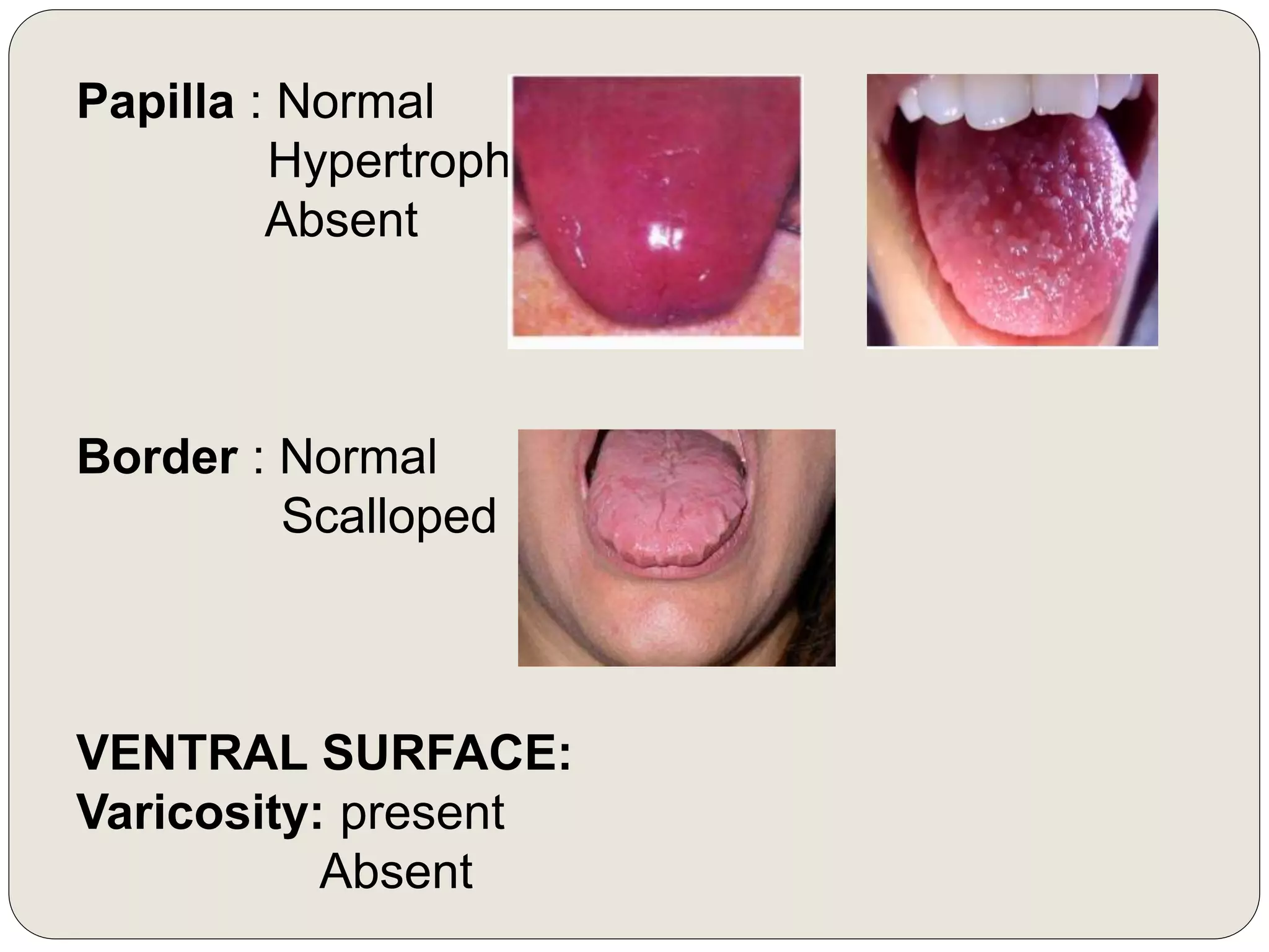 Intra oral examination | PPTX