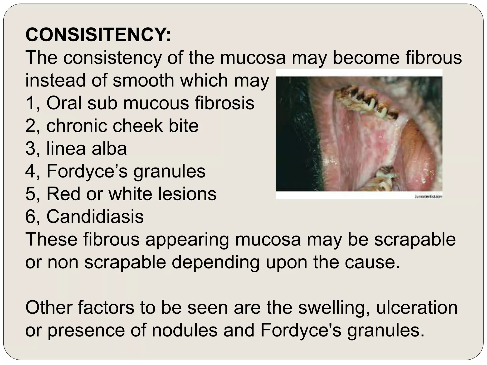 Intra oral examination | PPTX