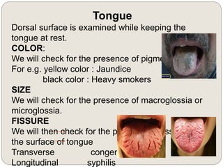Intra oral examination | PPTX