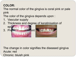 Intra oral examination | PPTX