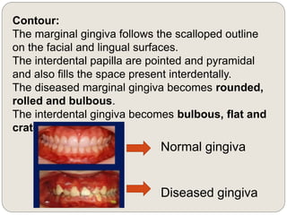 Intra oral examination | PPTX