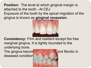 Intra oral examination | PPTX