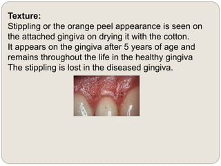 Intra oral examination | PPTX