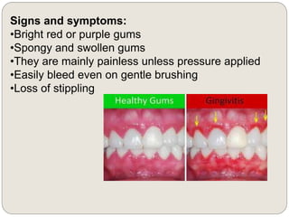 Intra oral examination | PPTX