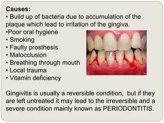 Intra oral examination | PPTX