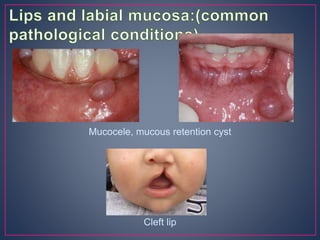 Intra oral examination (lips and labial mucosa) | PPT