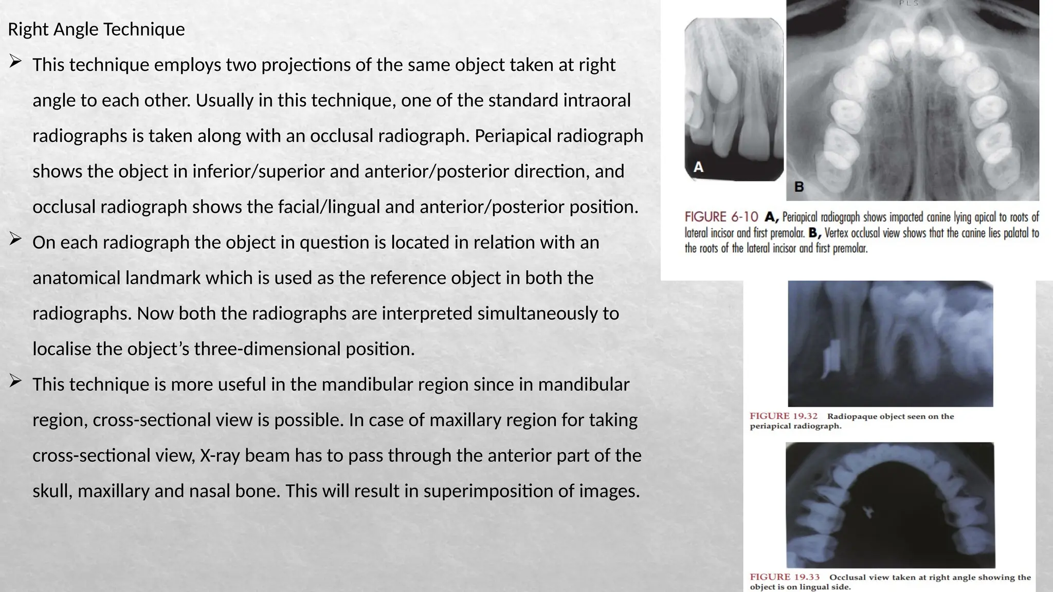 INTRAORAL IMAGING TECHNIQUE, ORAL RADIOLOGY | PPTX
