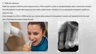 INTRAORAL IMAGING TECHNIQUE, ORAL RADIOLOGY | PPTX