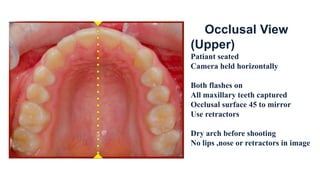 Intraoral photography | PPTX