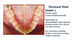 Intraoral photography | PPTX