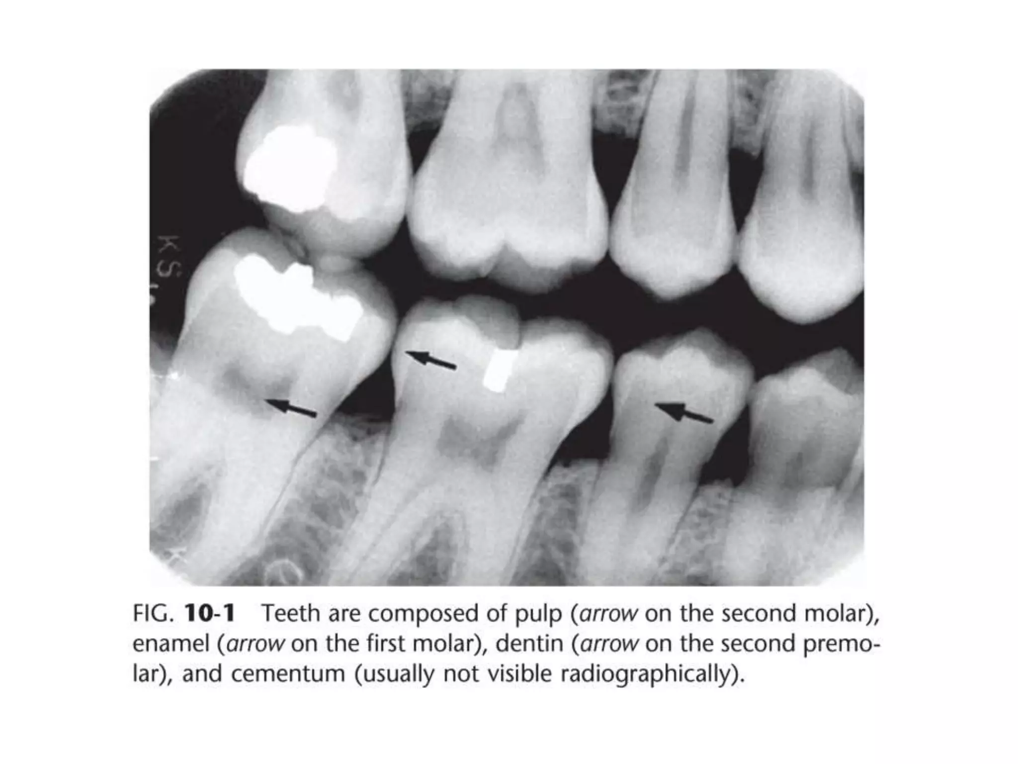 Intraoral radiographic anatomy | PPTX